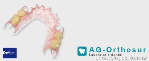 Prótesis flexibles calidad y garantía de deflex. Odontóloga Dra ...
