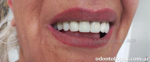 Prótesis Dentales J & C R - 1149741771 Laboratorio especializado en ...