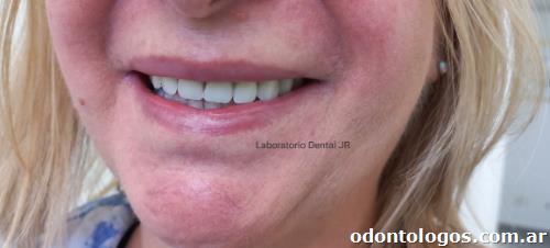 Prótesis Dentales J & C R - 1149741771 Laboratorio especializado en ...